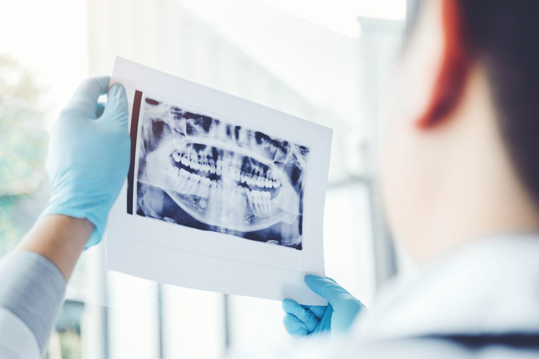 What Is Tooth Pulp Vitality? - General Dentist in Rockville, MD